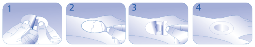 Pharmagel Comfort Island Dressings | IMS Euro